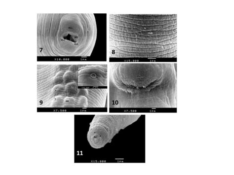 Scanning Electron Micrographs Of Female Capillaria Sp Treated With