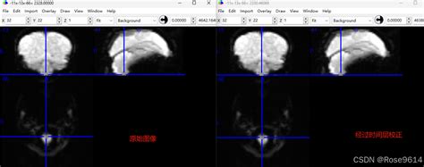基于dpabi和spm12的脑脊液（csf）分割和提取笔记 spm12分割 csdn博客