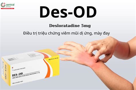 Thuốc Des Od 5mg điều Trị Giảm Triệu Chứng Của Viêm Mũi Dị ứng Mày đay Tự Phát Mạn Tính