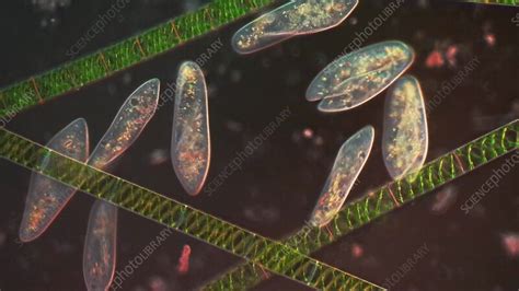 Paramecium Caudatum Protists Dividing Light Microscopy Stock Video