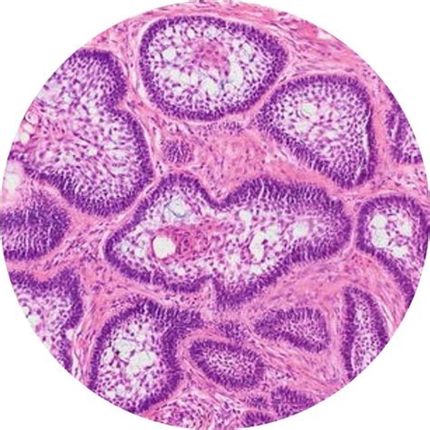 Hints In Oral Pathology Mansourah