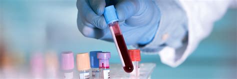 Case Study Deadly Blood Transfusion Error