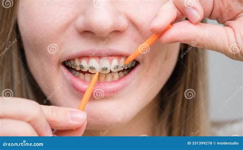 Unrecognizable Caucasian Woman Cleans Braces With A Brush Close Up Of
