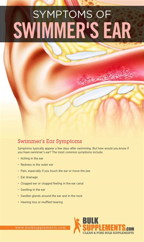 Swimmers Ear For Ear Infection At Rebecca Dawson Blog