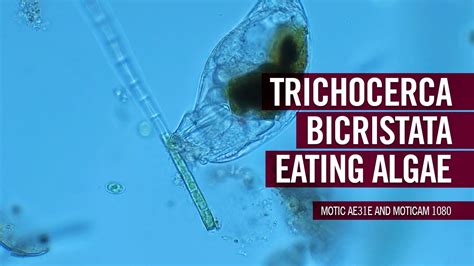 Trichocerca Bicristata Eating Algae By Motic Europe Youtube