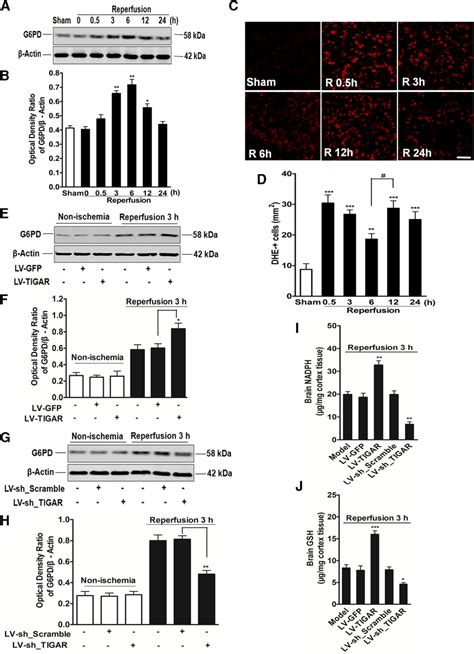 Tigar Increases Ppp Flow By Regulating G6pd A B Time Course Of G6pd