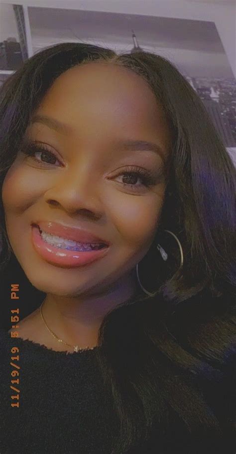 Braces Black Women With Braces Braces Colors Brace Face Braces Cost