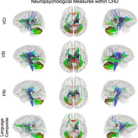 Tracks Where Tpc Chd While Controlling For Sex This Contains Much Of Download Scientific