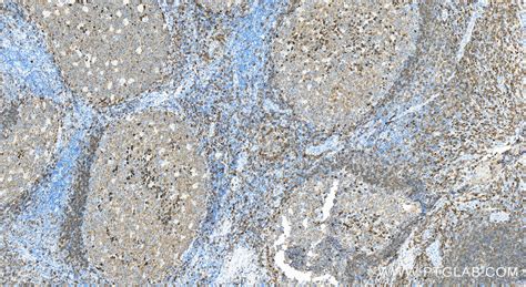 Cd79a Antibody 84236 4 Rr Proteintech