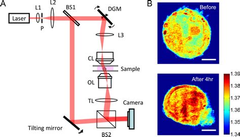 Imaging Myeloma Cells With Digital Holographic Tomography A Digital
