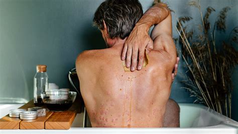 Psoriasis Can Affect Your Organs