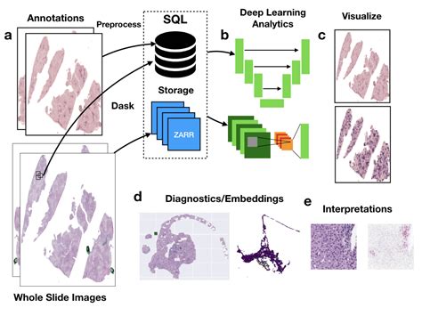 Github Jlevy44pathflowai A High Throughput Workflow For