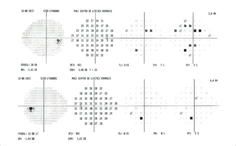 Campimetría Computarizada 24 2 A Los 2 Años 6 Meses De Presentación