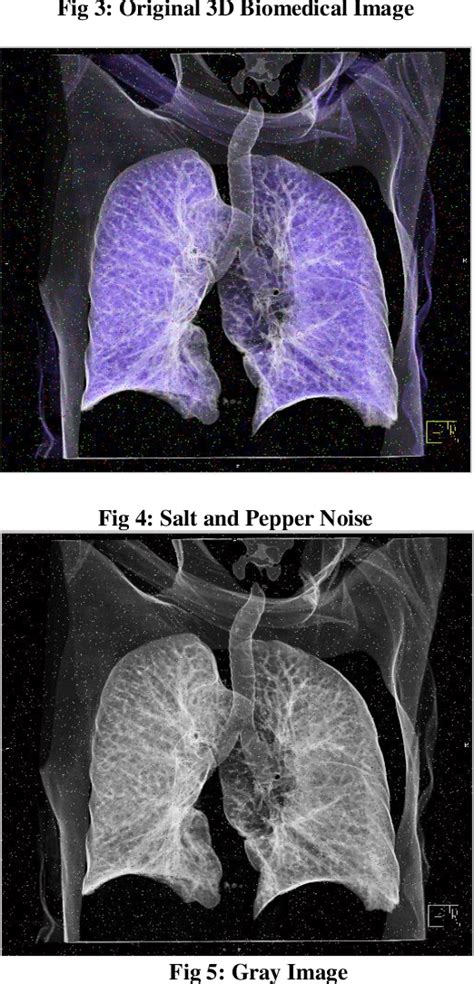 figure 4 from implementing morphological operators for edge detection