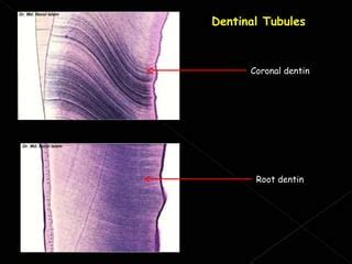 Histology Of Dentin Ppt