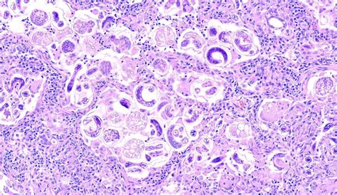 Lungworm In Cats Our Vet Explains Causes Signs And Treatments Hepper