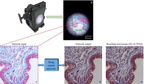 Figure 1 From Deep Learning Enhanced Mobile Phone Microscopy Semantic Scholar