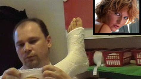 Timi With Sprain Gets Her Plaster Slc Casted Memories Casts Clips4sale