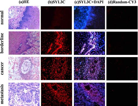 Series Of Immunostained Ec Tissue Sections Probed By Epcam Aptamer