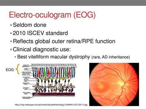 Ppt Clinical Electrophysiology Powerpoint Presentation Free Download Id 1937179