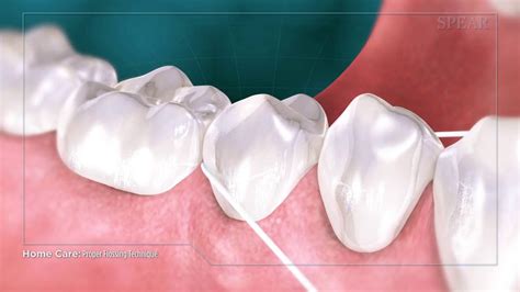 Proper Flossing Technique Mint Hill Dentistry