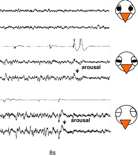 eeg amplitude and sw activity progressively increase from alert