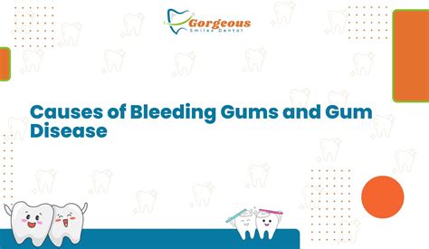 Causes Of Bleeding Gums And Gum Disease Gorgeous Smiles Dental