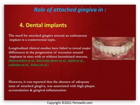 Attached Gingiva And Procedures For Gingival Augmentation Pptx Oral