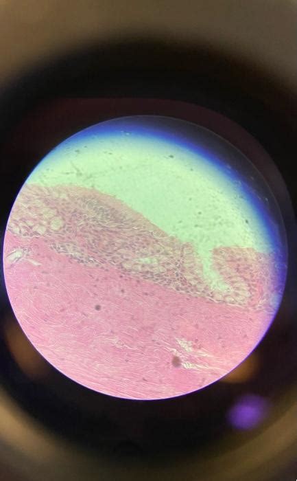 Solved Label The Structure Of Epithelial Cell Tissue
