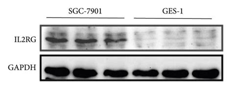 Western Blotting And Rt Qpcr Showing The Il2rg Expression Levels In