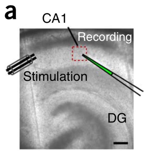 8 Questions With Answers In Schaffer Collateral Science Topic