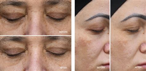 Smoothing Beauty Wands For Eye Face And Neck Wrinkles Shaklee