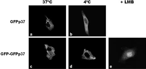 Effect Of Temperature Shift And Treatment With Lmb On The Subcellular Download Scientific