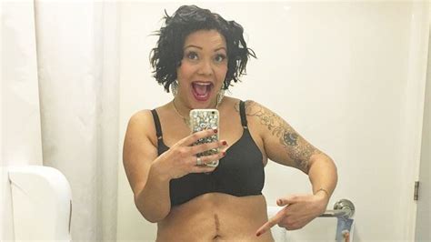 What Sex Is Like With A Stoma Bag Woman Reveals How Her Relationship