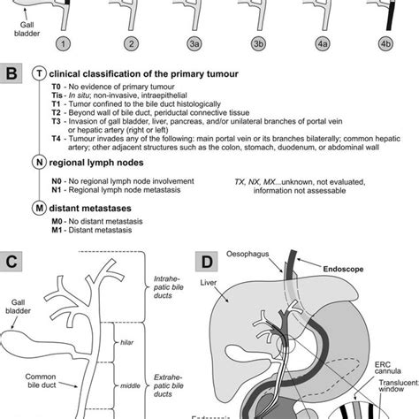 Anatomy Bismuth Tnm Classification And Pdt For Hilar Download Scientific Diagram