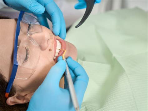 What Is Ipr Invisalign At Thomas Sell Blog
