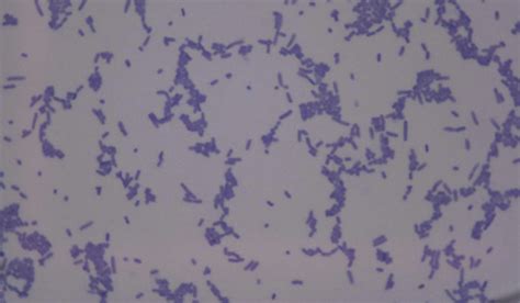 Bacillus Subtilis Microscope
