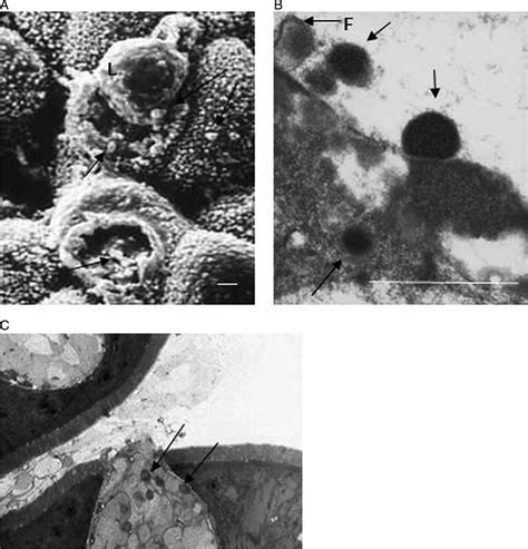 Unidentified Intralesional And Intracellular Coccoid Microorganism