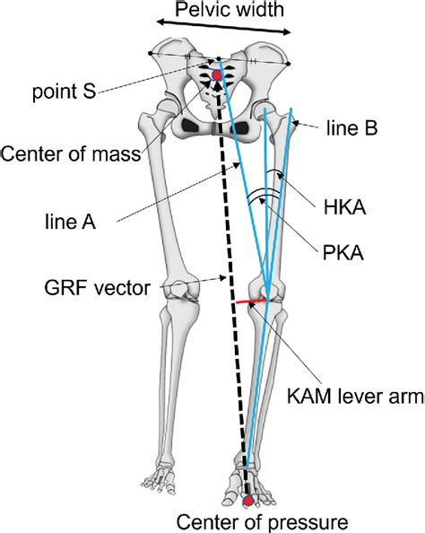 Figure 1 From Higher Association Of Pelvis Knee Ankle Angle Compared With Hip Knee Ankle Angle
