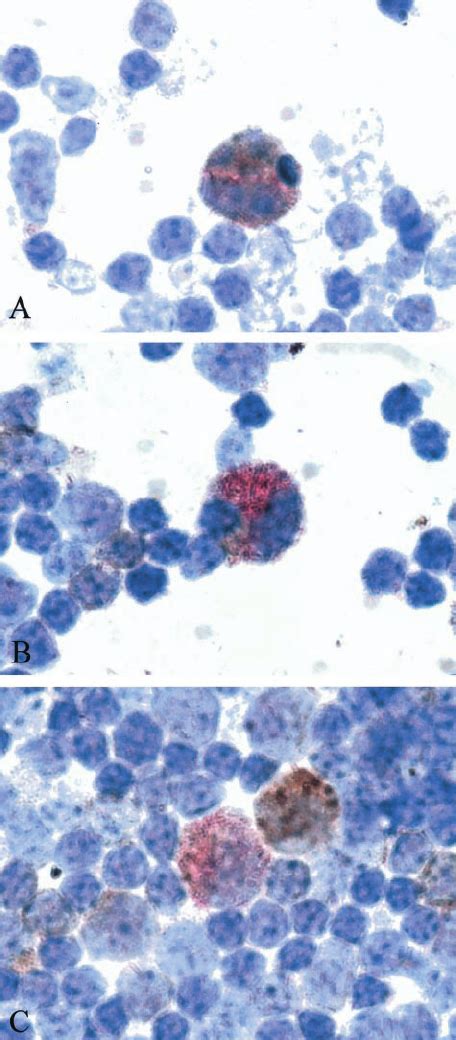 Dual Ihc Co Localization Of Prp Sc Using Prp Specific Mab 999761