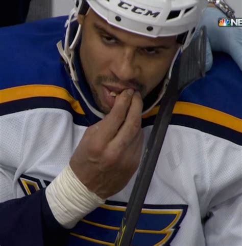 What Percentage Of Nhl Players Are Missing Teeth At Richard Montejano Blog