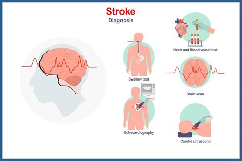 Healthcare Concept Illustrationvector In Flat Style Of Stroke Diagnosis Brain Scan Heart And