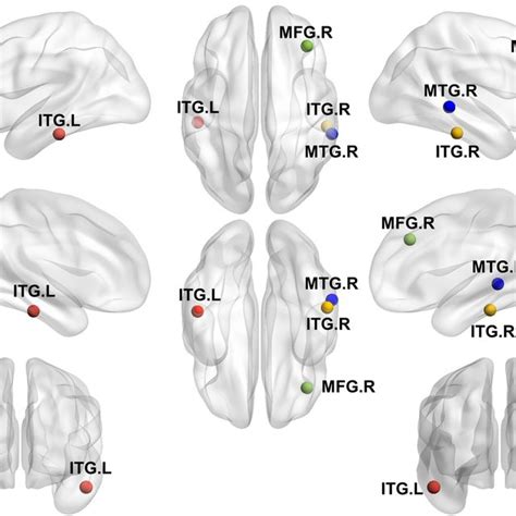 Four Main Brain Regions Characterizing The Alterations Of Functional