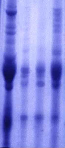 Sds Page Of Igy Precipitate Of Various Purification Methods Under Download Scientific Diagram