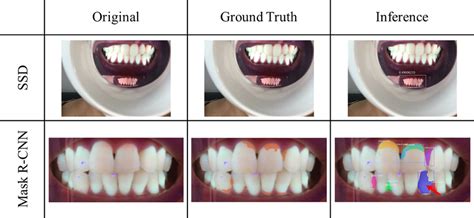 Representative Poor Results Of Each Deep Learning Algorithm Download
