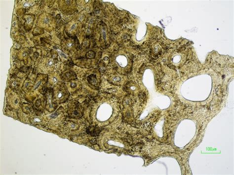 Aandp Osseous Tissue Diagram 2 Diagram Quizlet
