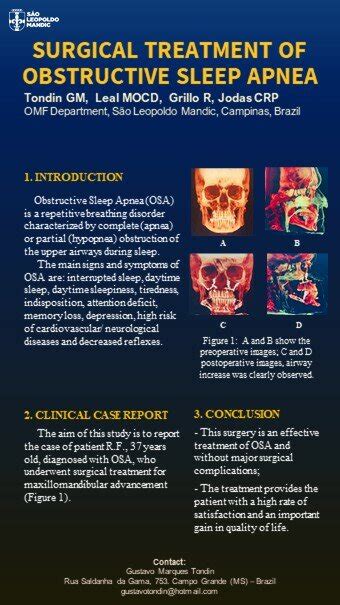 Pdf Surgical Treatment Of Obstructive Sleep Apnea