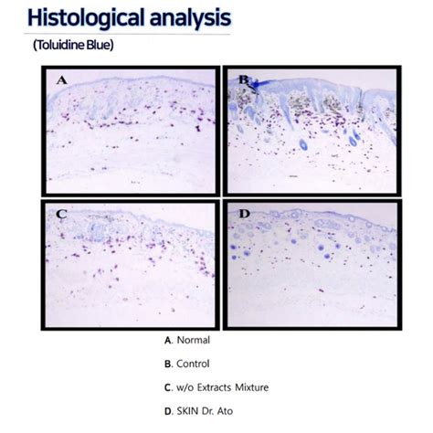 Atopic Dermatitis Treatment Patch K Beauty Connect