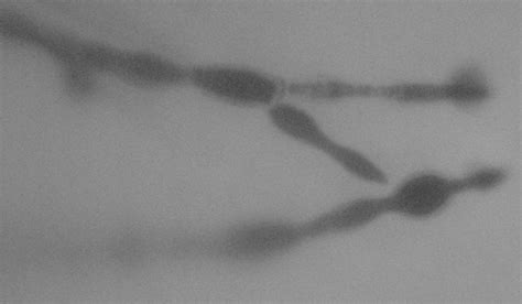 Atenuis Hyphal Modification As Result Of Antifungal Activity Of B2