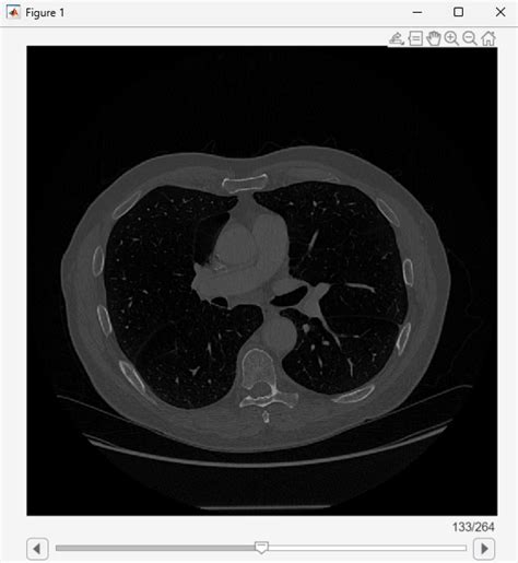 Updateorientation Update Slice Orientation Of Medical Volume Voxels Matlab